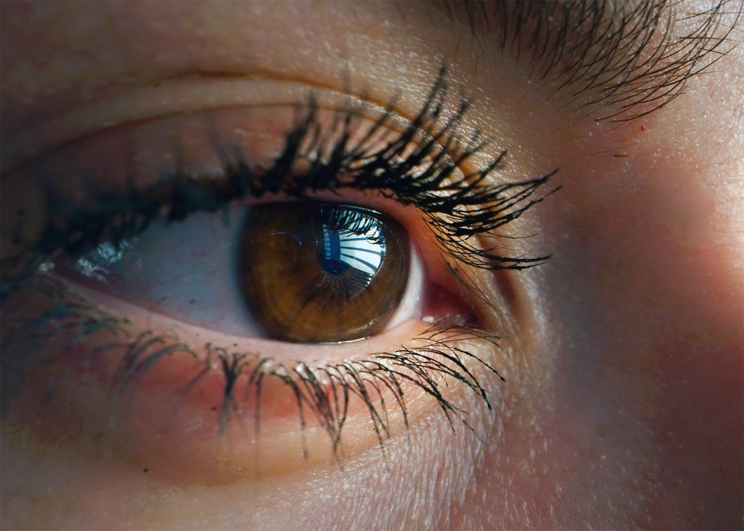 LASIK Eye Surgery Denver | LASIK Sheridan | LASIK Englewood